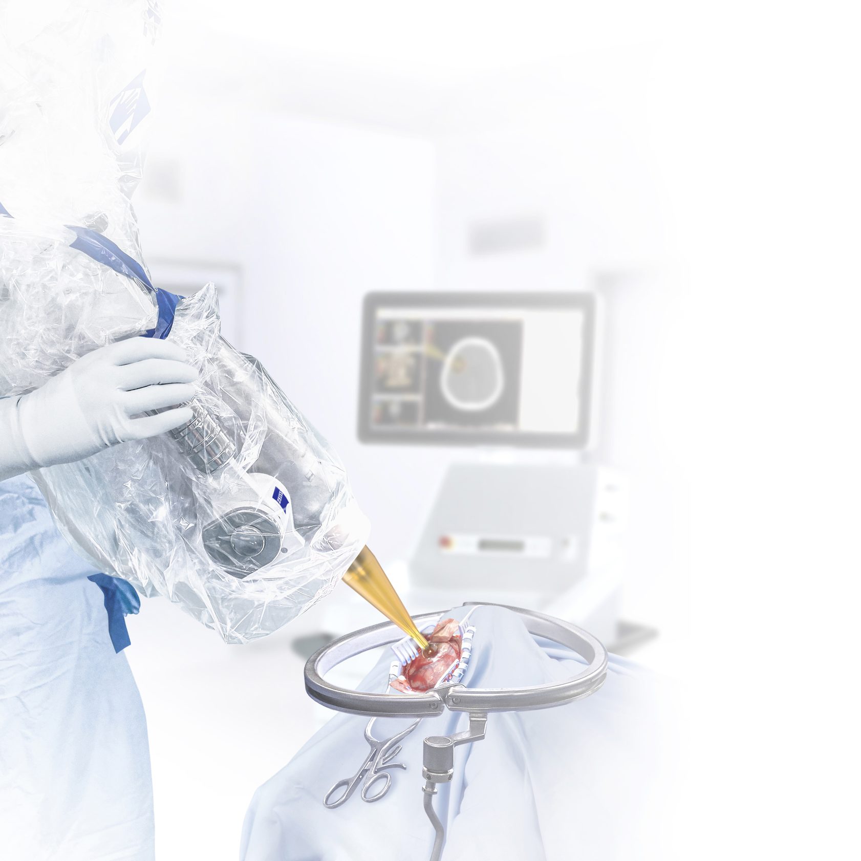 Intra-Operative Radiation Therapy (IORT) for Breast Cancer - MACS Clinic